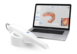 Intraoral scanners: Brand comparison, uses, and more | Dandy