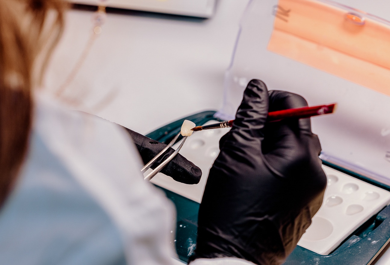 What to know about Zirconia crowns [from industry experts]