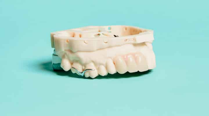 Digital Partial Denture Labs | Dandy