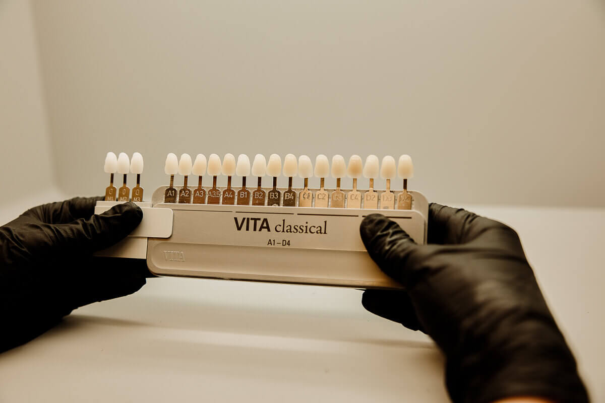 How To Effectively Capture Shade | Dandy