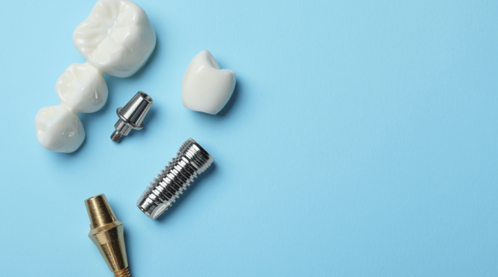 Tools every dentist should be using for dental implants - Dandy