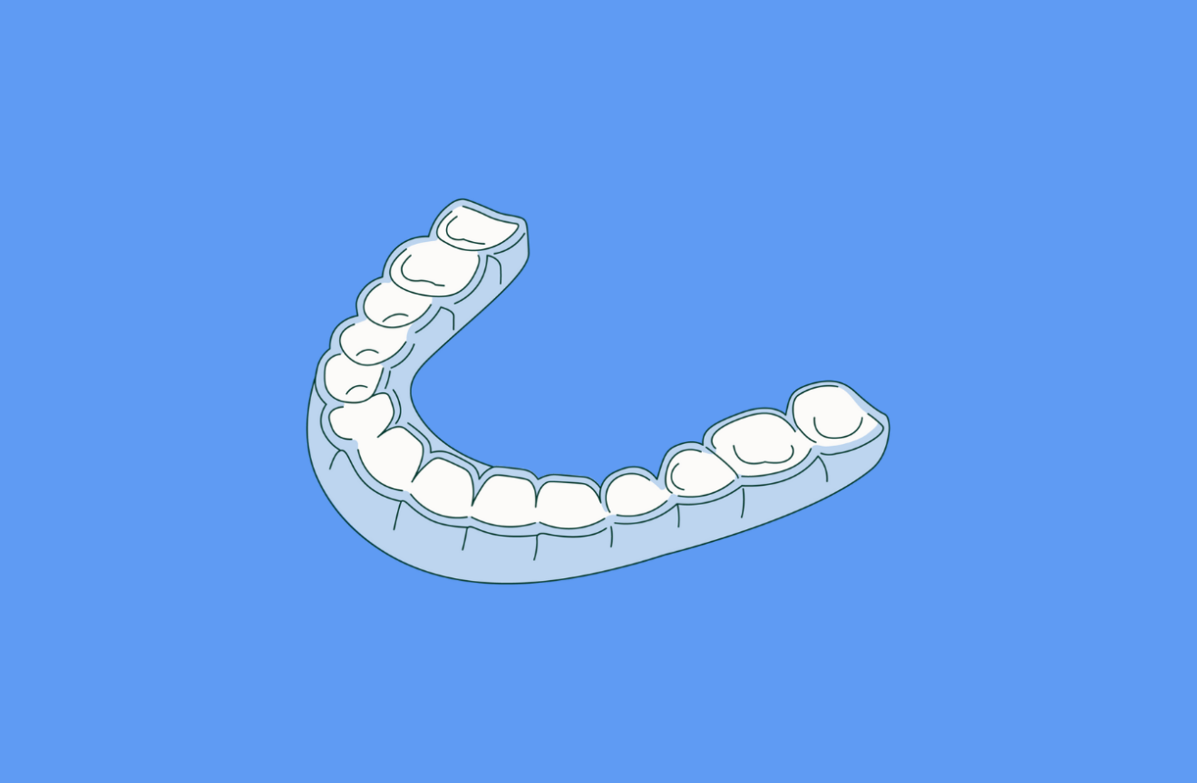 Hard vs Soft Night Guards: A timeless debate among dentists