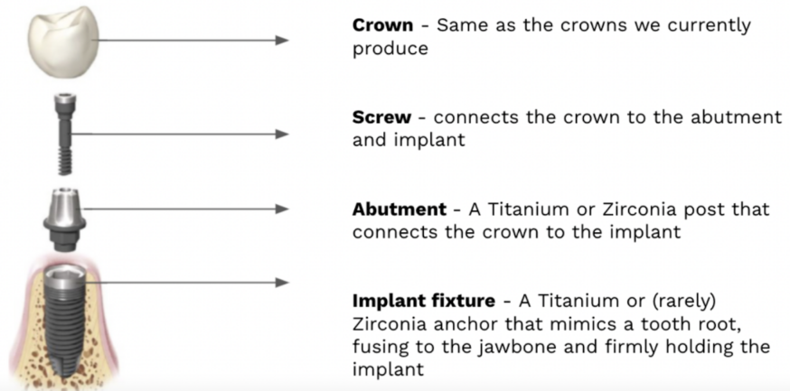 Dental Implant Parts: Components and Uses
