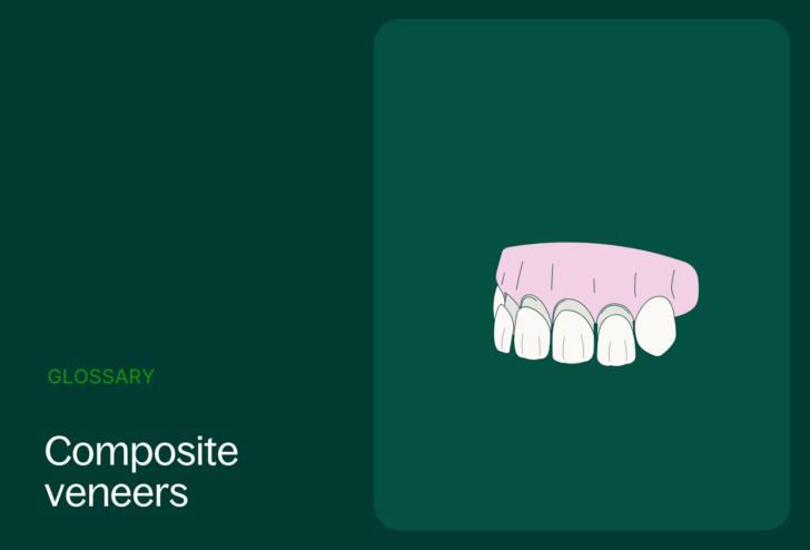 Dental composite restoration aka composite veneers