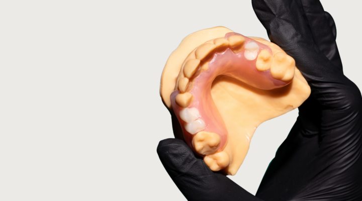 Implant Scan Body Lab | Dandy