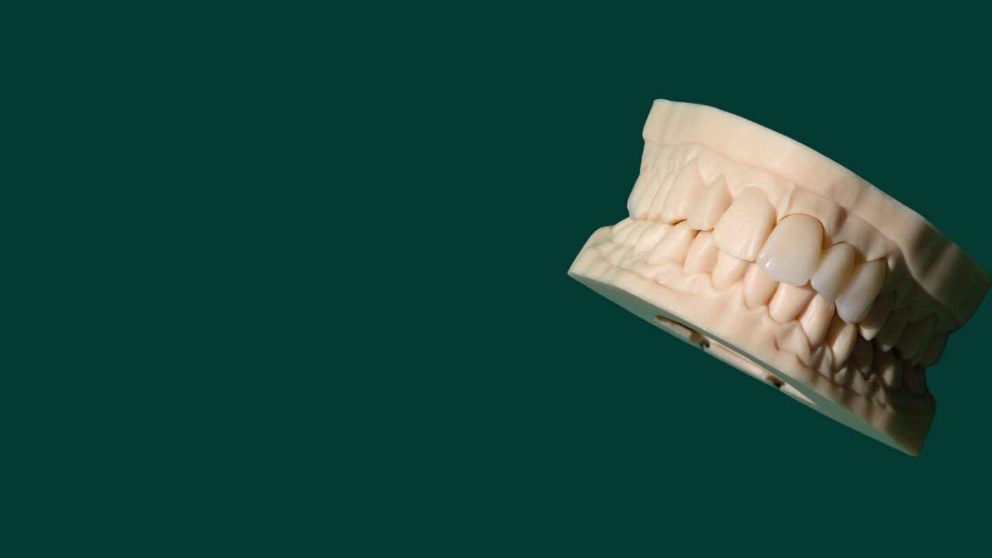 Anterior Crown and Bridge | Dandy