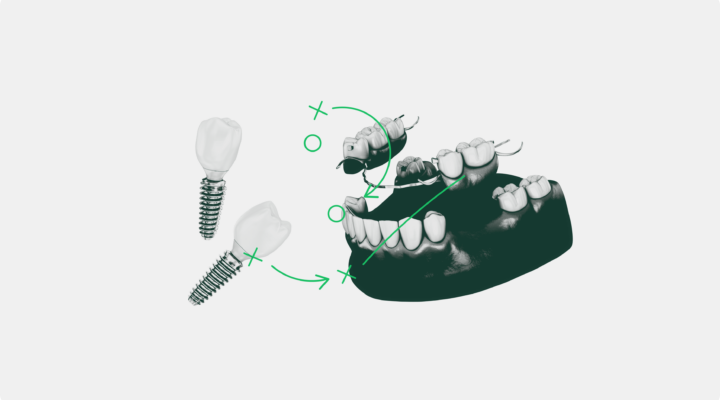 The guide to intraoral scan bodies: Everything you need to know - Dandy