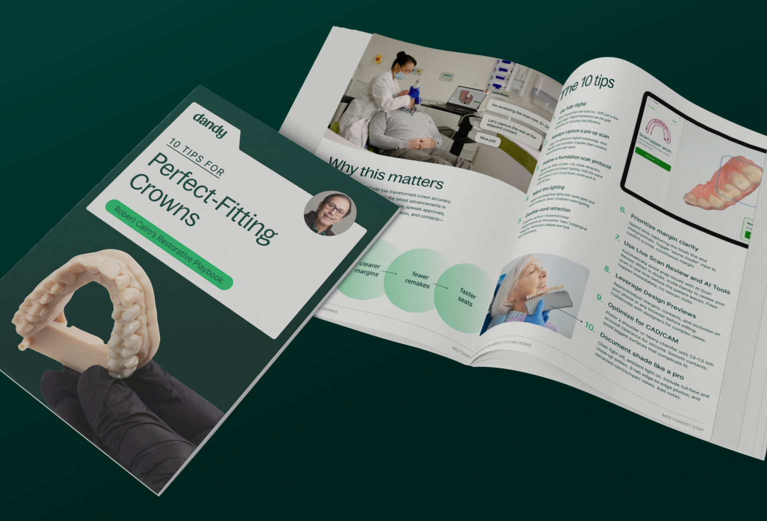 Case Study: 10 Tips for Perfect Fitting Crowns - Dandy